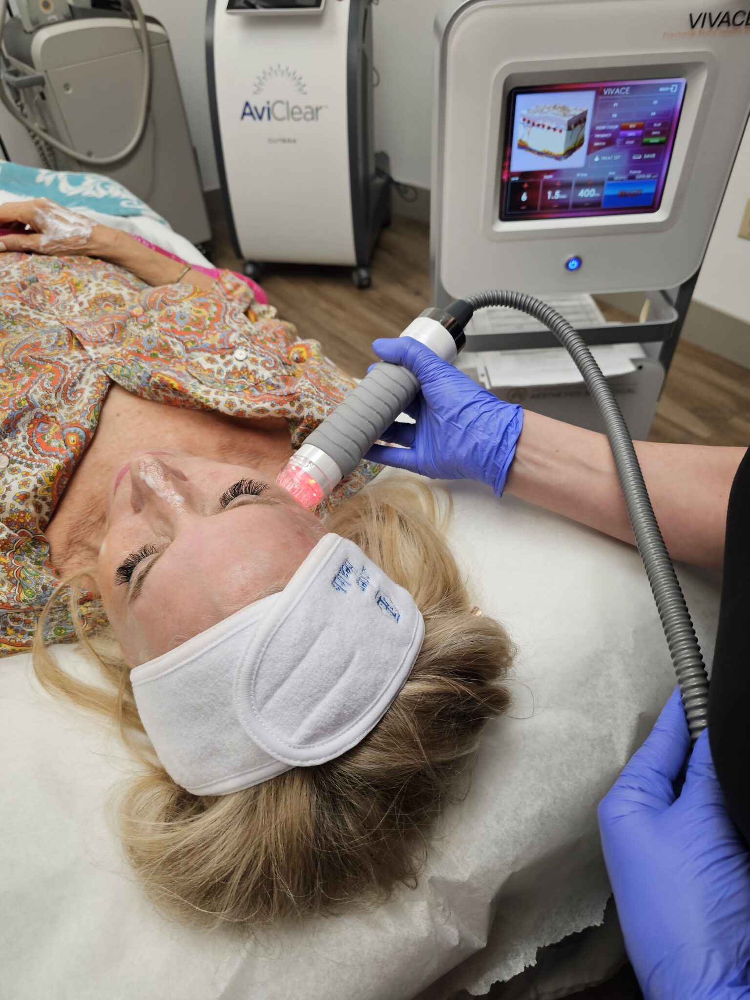 Vivace Micro-Needling with RF | Phoenix, AZ